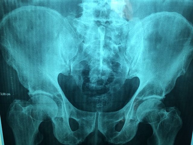 Definición de Medicina Forense | Concepto | Tipos de intervención